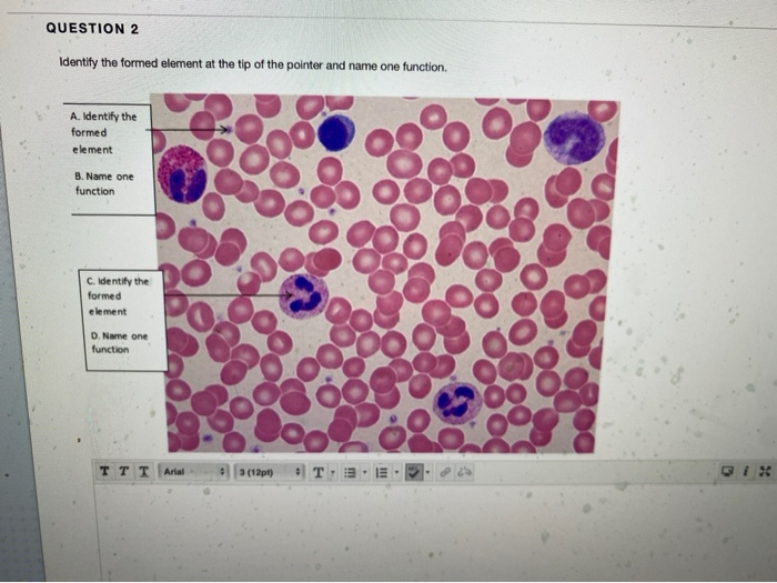 Solved QUESTION 2 Identify the formed element at the tip of | Chegg.com