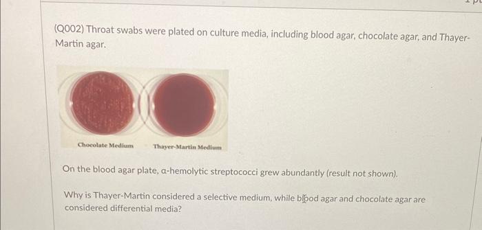 Solved (Q002) Throat swabs were plated on culture media, | Chegg.com