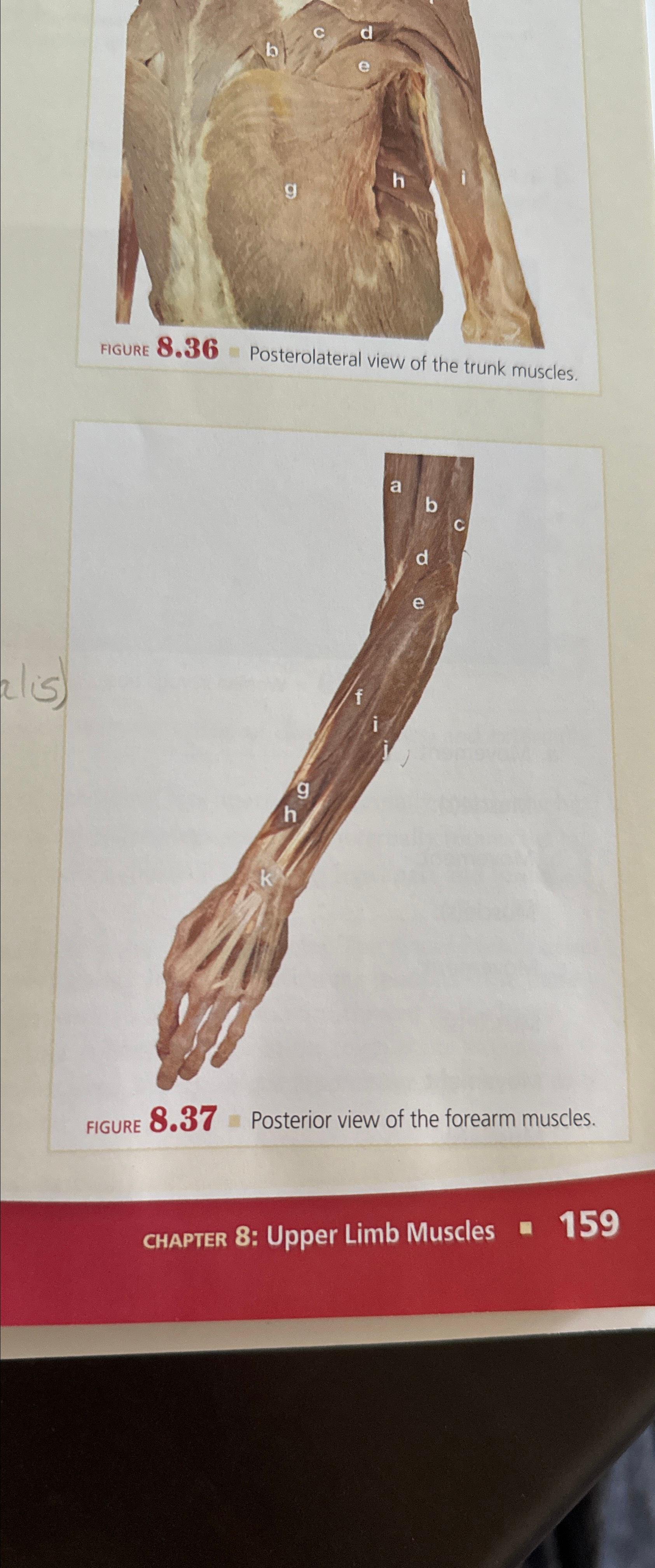 Solved I identify the muscles and structures indicated and | Chegg.com
