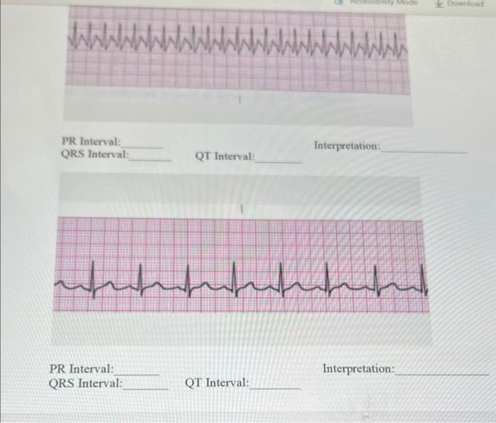 Solved PR Interval: QRS Interval: QT Interval: | Chegg.com