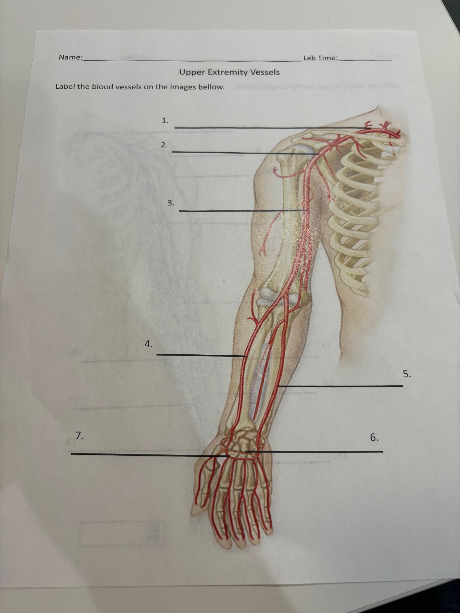 Solved Name: Lab Time:Upper Extremity VesselsLabel the blood | Chegg.com