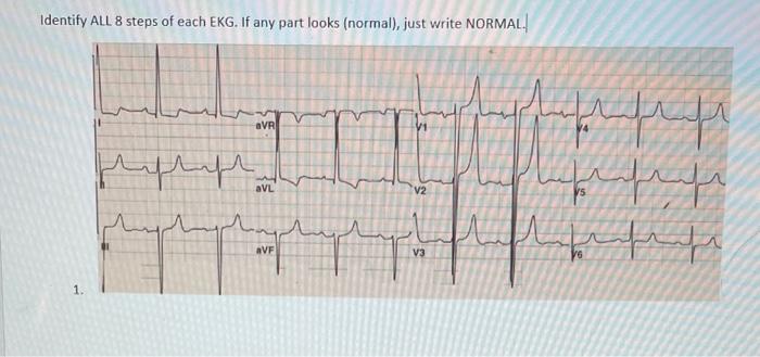 Solved Identify ALL 8 steps of each EKG. If any part looks | Chegg.com