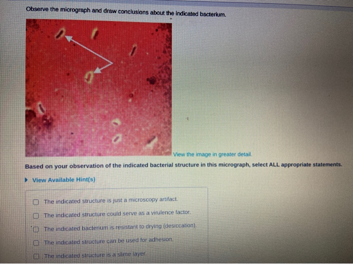 Solved Observe the micrograph and draw conclusions about the | Chegg.com