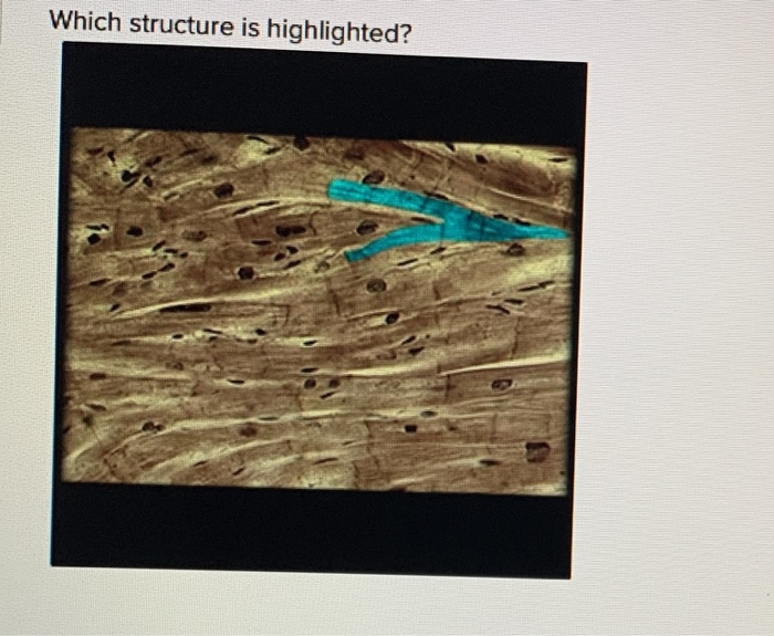 Solved Which structure is highlighted? Which structure is | Chegg.com