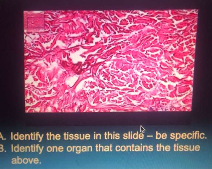 Solved 1. Identify the tissue in this slide - be specific. | Chegg.com