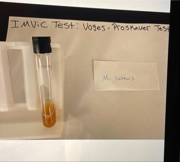 Solved PART B: Methyl Red Test and Voges-Proskauer Test | Chegg.com