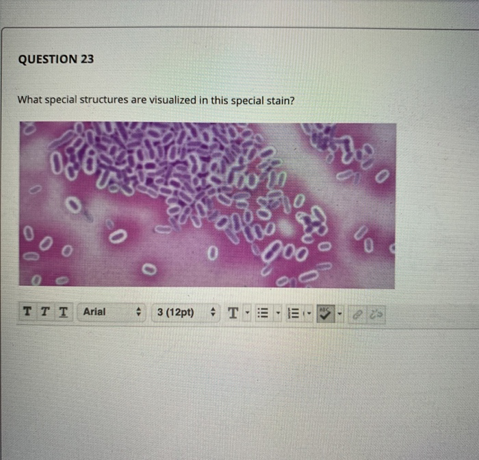 Solved QUESTION 23 What special structures are visualized in | Chegg.com