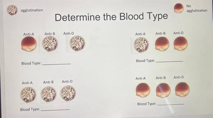 Solved agglutination Determine the Blood Type No | Chegg.com