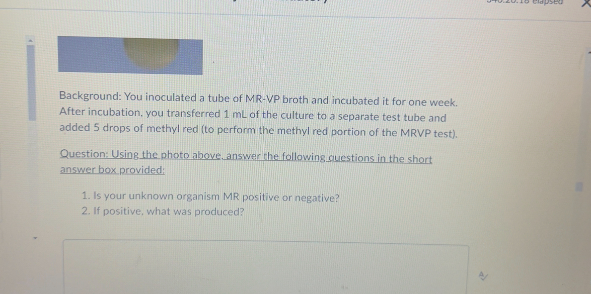 Solved Background: You inoculated a tube of MR-VP broth and | Chegg.com