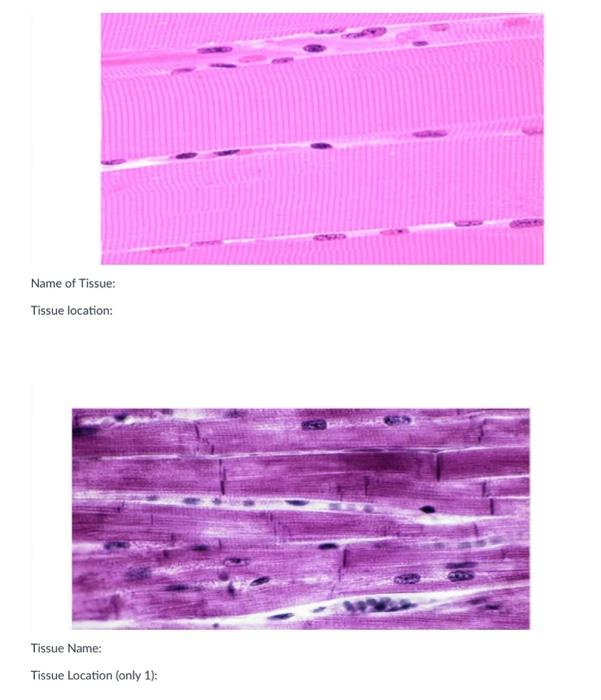 Solved Tissue Name: Tissue Location (only 1): Tissue | Chegg.com