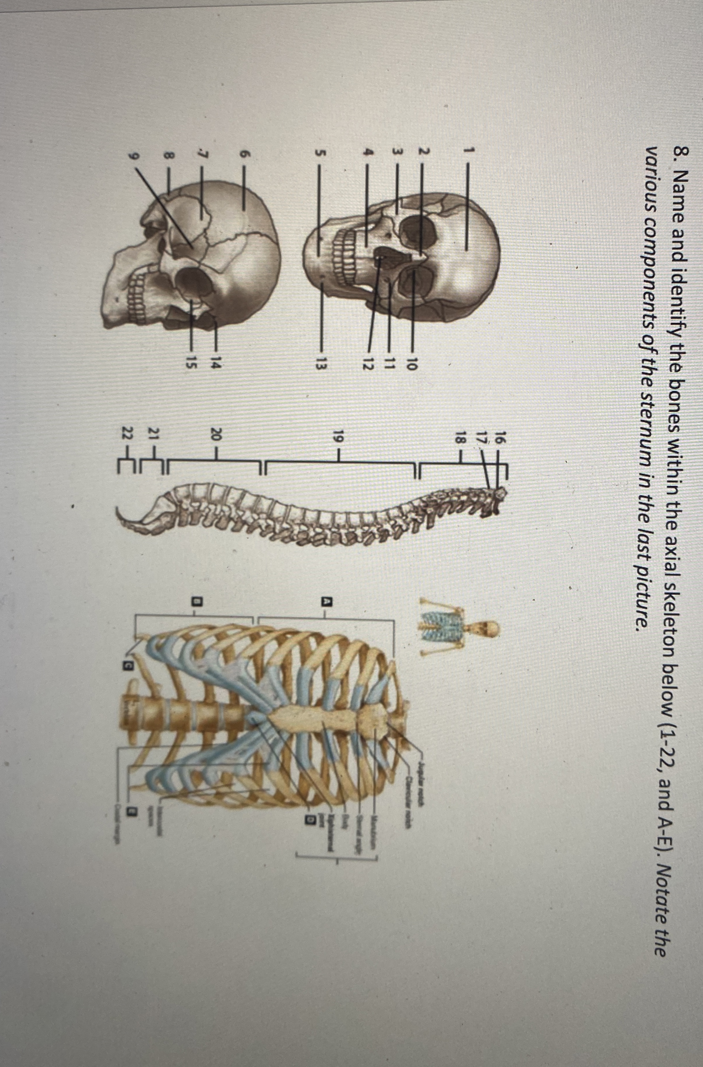 Solved Name and identify the bones within the axial skeleton | Chegg.com