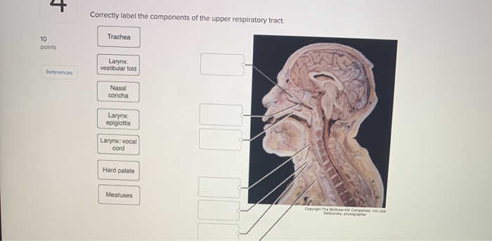 Solved 4 Correctly label the components of the upper | Chegg.com
