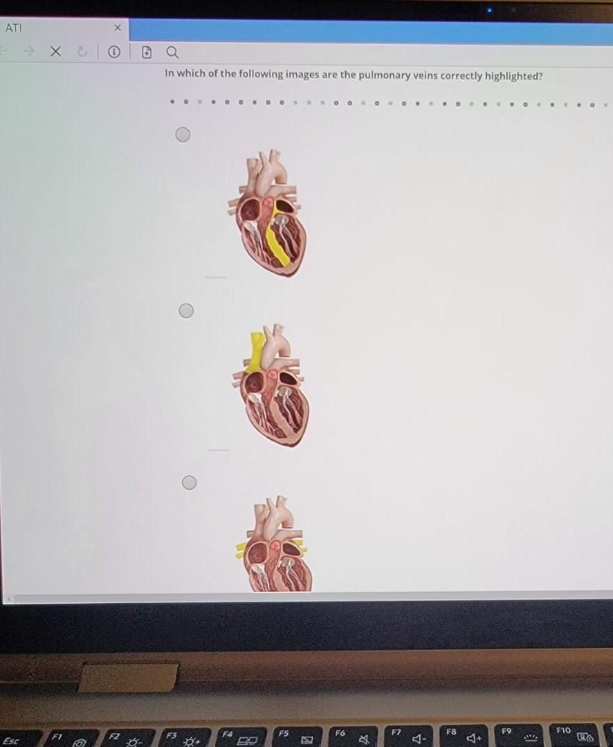Solved In which of the following images are the pulmonary | Chegg.com