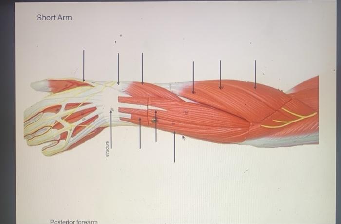 Solved Short Arm Anterior Full Upper Limb showing the medial | Chegg.com