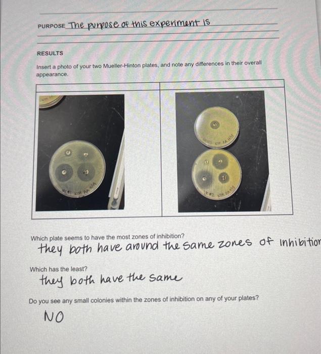Solved RESULTS Insert a photo of your two Mueller-Hinton | Chegg.com