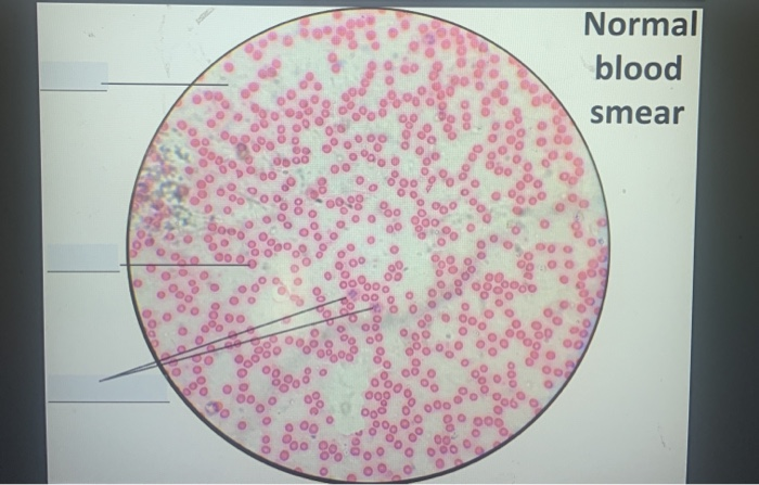 Solved Normal blood smear 00 | Chegg.com