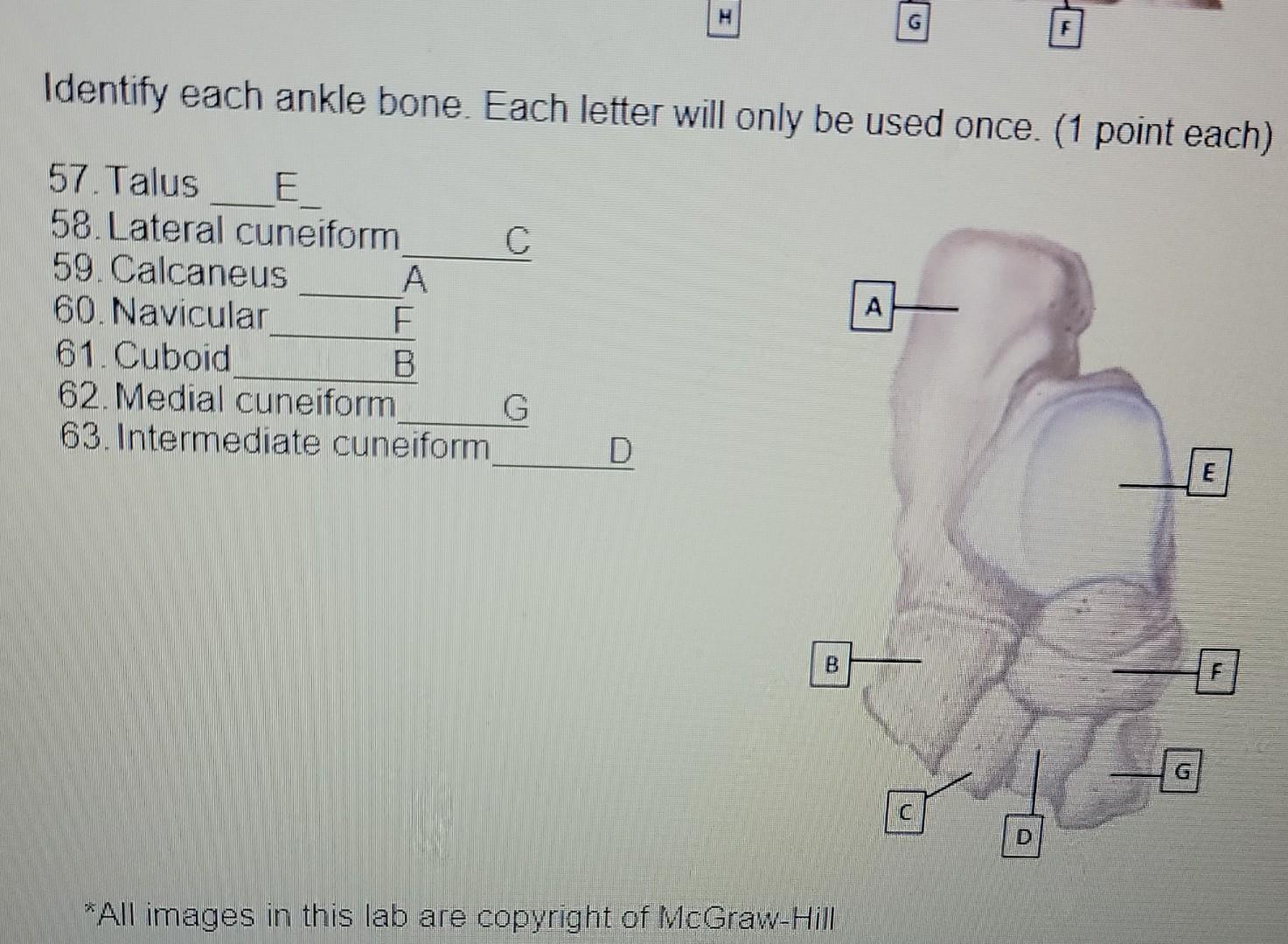 Solved Activity 6: Hand and Foot Name the 3 groups of bones | Chegg.com