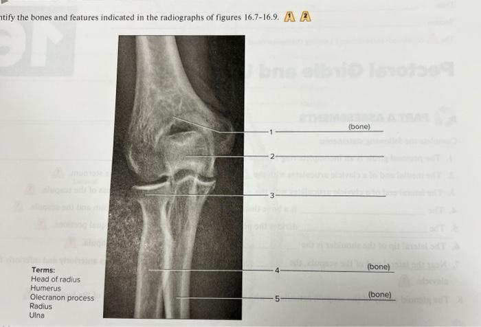 Solved identify the bones and features indicated in the | Chegg.com