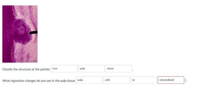 Solved Classify the structure at the pointer true pulp stone | Chegg.com