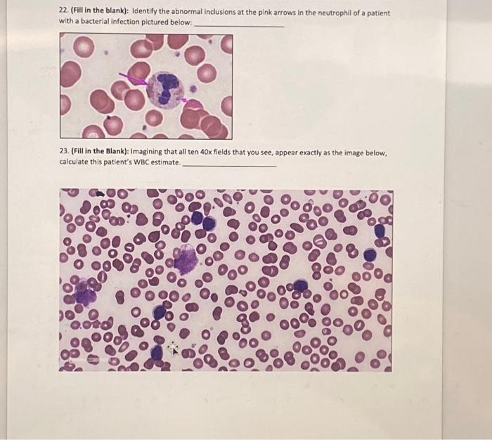 Solved 19. (Fill in the blank): Identify the RBC change | Chegg.com