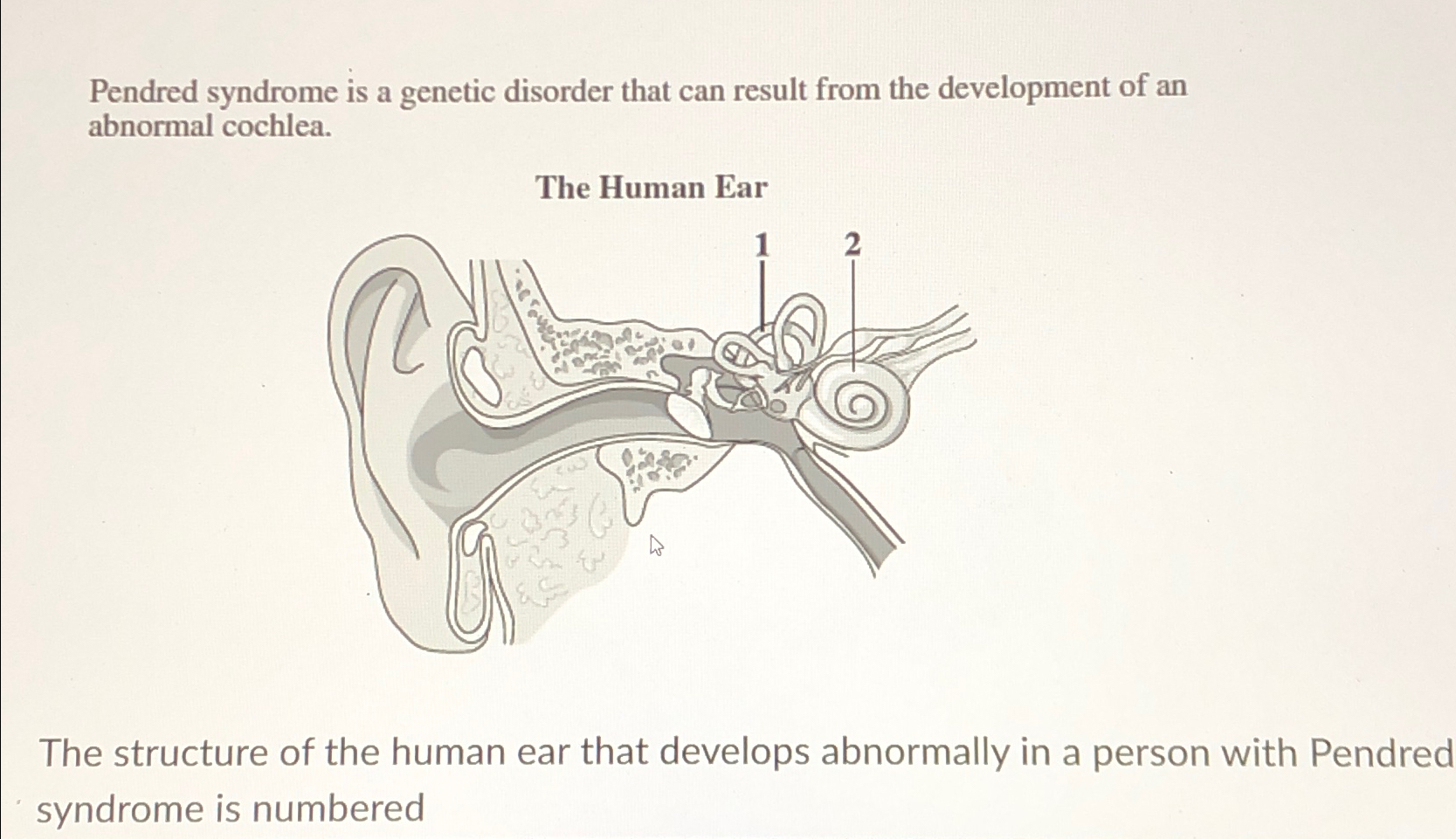 Solved Pendred syndrome is a genetic disorder that can | Chegg.com