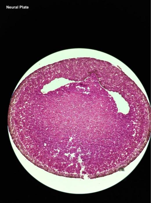 Solved Neural Tube Neural Fold | Chegg.com