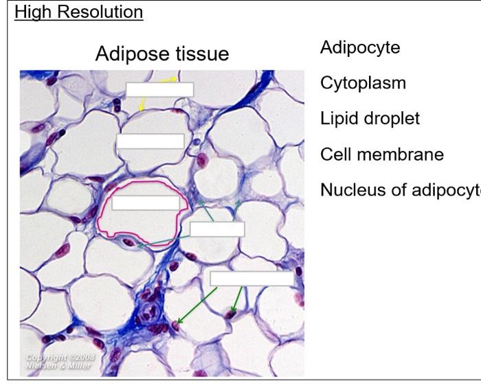 Solved High Resolution Adipose tissue Copyright 2008 Nielsen | Chegg.com