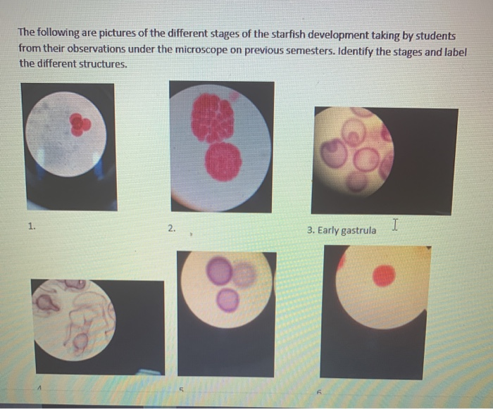 Solved The following are pictures of the different stages of | Chegg.com