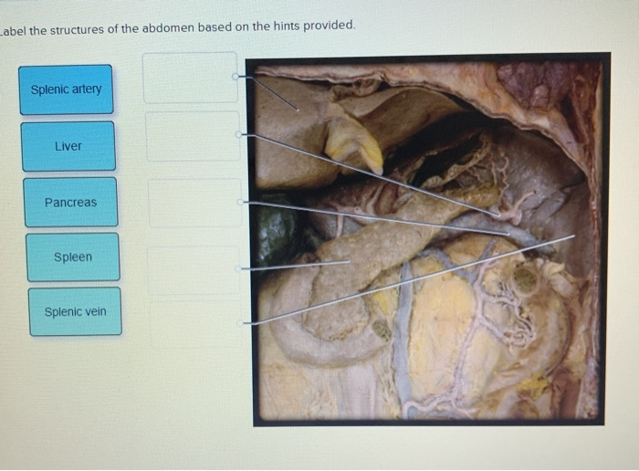Solved Label the structures of the abdomen based on the | Chegg.com
