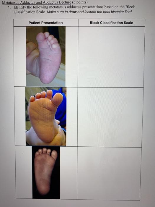 Solved Metatarsus Adductus and Abductus Lecture (3 points) | Chegg.com