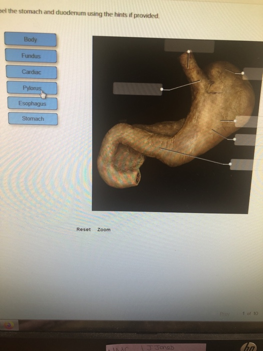 Solved bel the stomach and duodenum using the hints if | Chegg.com