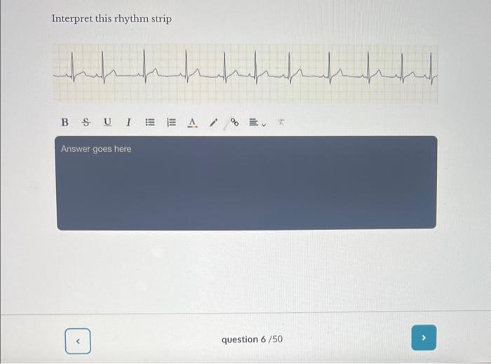 Solved Interpret this rhythm strip Interpret this rhythm | Chegg.com