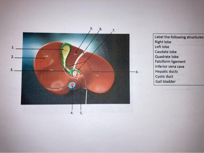 Solved 00 1. 2. Label the following structures Right lobe | Chegg.com