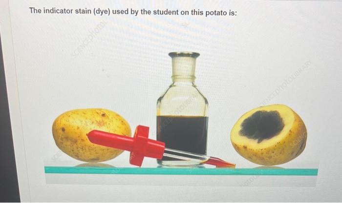 Solved The indicator stain (dye) used by the student on this | Chegg.com