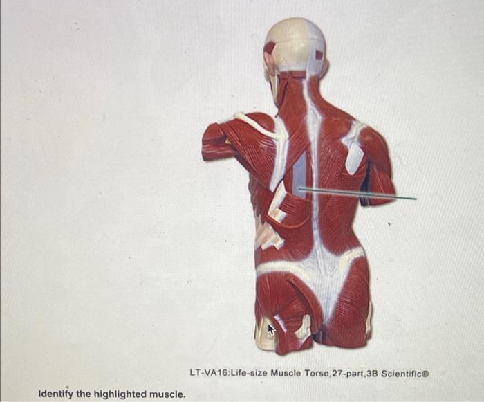 Solved Identify the highlighted muscle. LT-VA16:Life-size | Chegg.com
