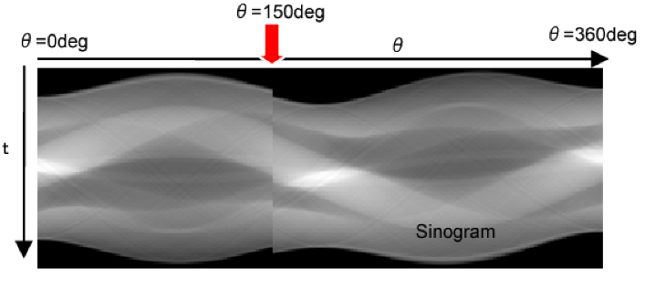 Solved Below is a sinogram with an artifact at 150 ﻿degrees. | Chegg.com