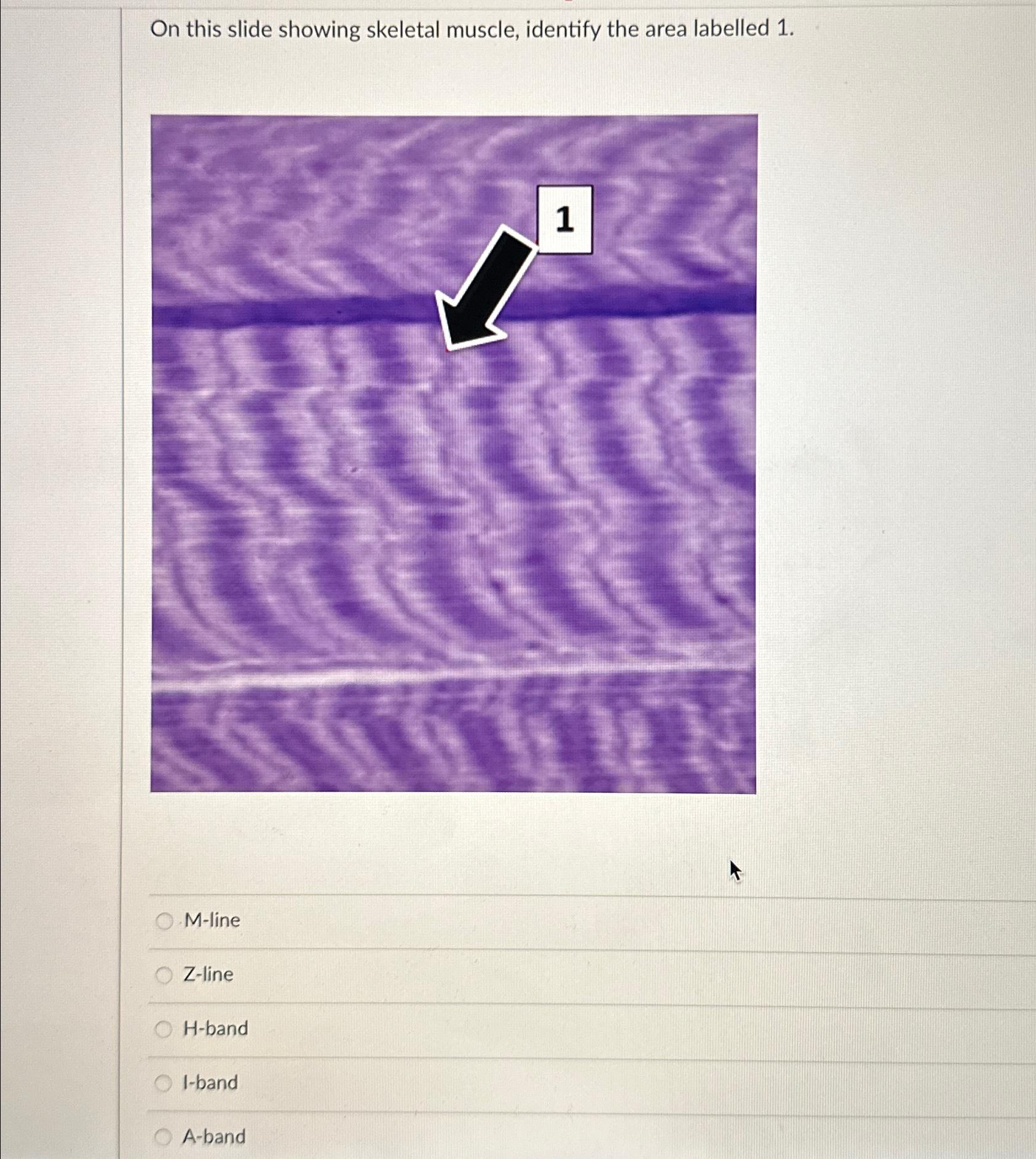 Solved On this slide showing skeletal muscle, identify the | Chegg.com