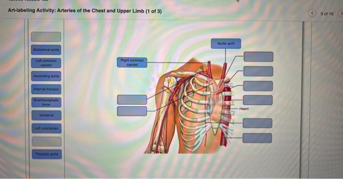 Solved Art-labeling Activity: Arteries of the Chest and | Chegg.com