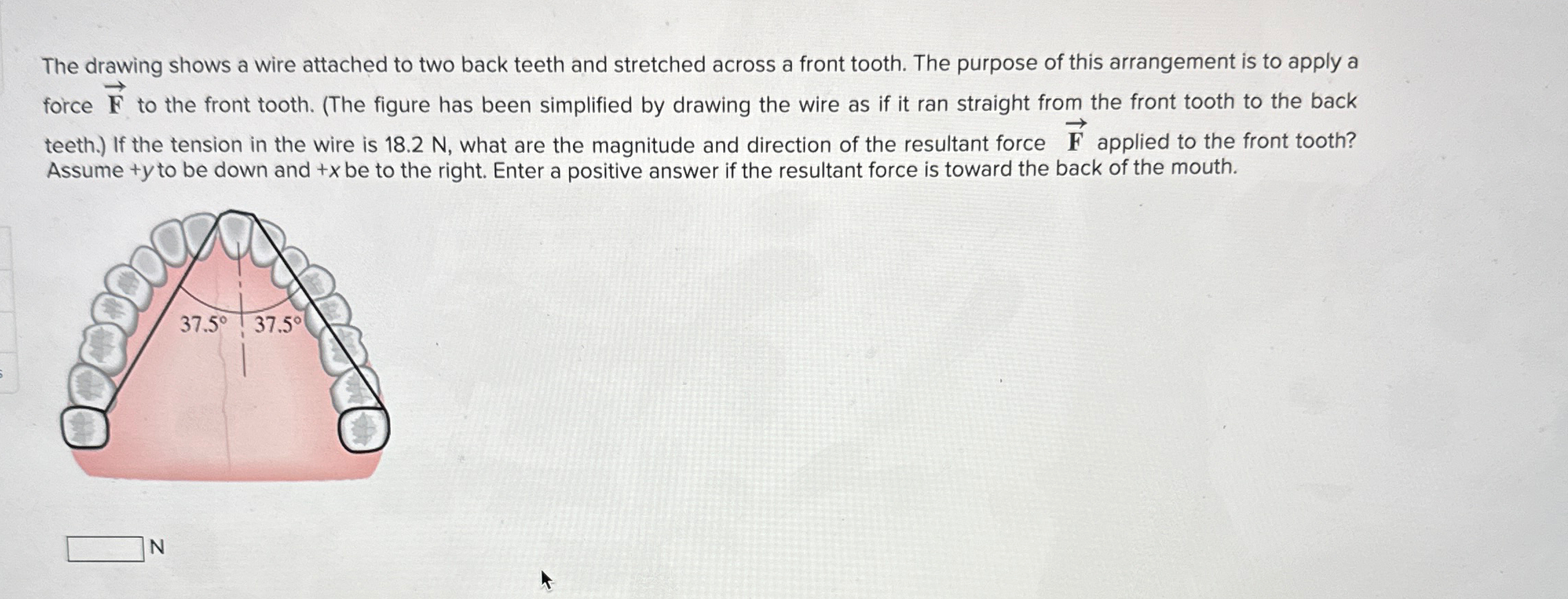 Solved The drawing shows a wire attached to two back teeth | Chegg.com