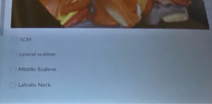 Solved SCM Lateral scalene Middle Scalene Latralis Neck | Chegg.com