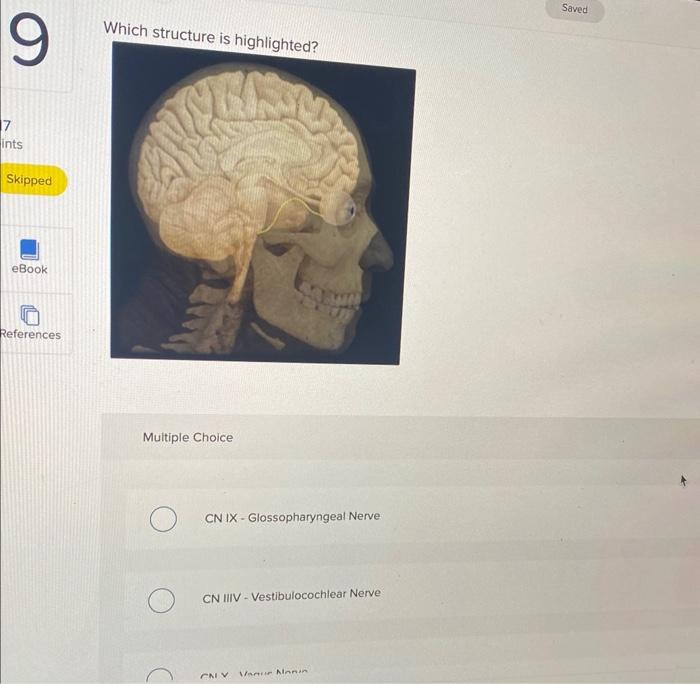 Which structure is hirnhl:-L. Multiple Choice CN IX - | Chegg.com