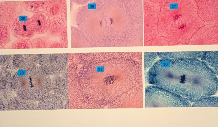 Solved cell division- label it | Chegg.com