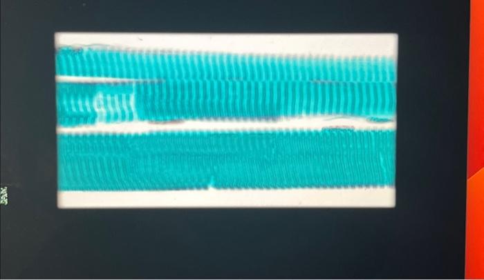 Solved What structure is highlighted? A. Inferior rectus | Chegg.com