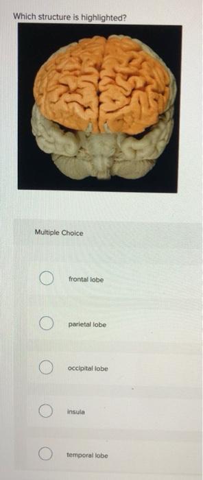 Solved Which structure is highlighted? Multiple Choice O | Chegg.com