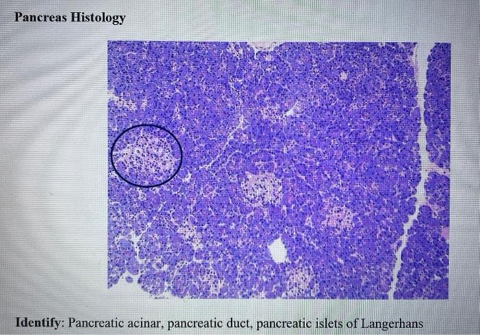 Solved Pancreas Histology Identify: Pancreatic acinar, | Chegg.com
