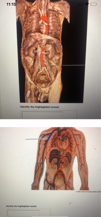 Solved The highlighted vessel is a continuation of what | Chegg.com Solved The highlighted vessel is a continuation of what | Chegg.com