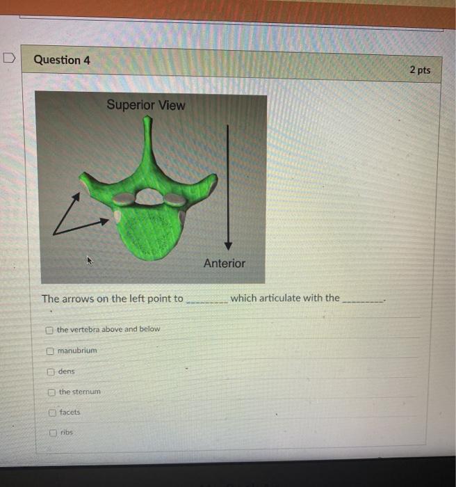 Solved Question 4 2 pts Superior View Anterior The arrows on | Chegg.com