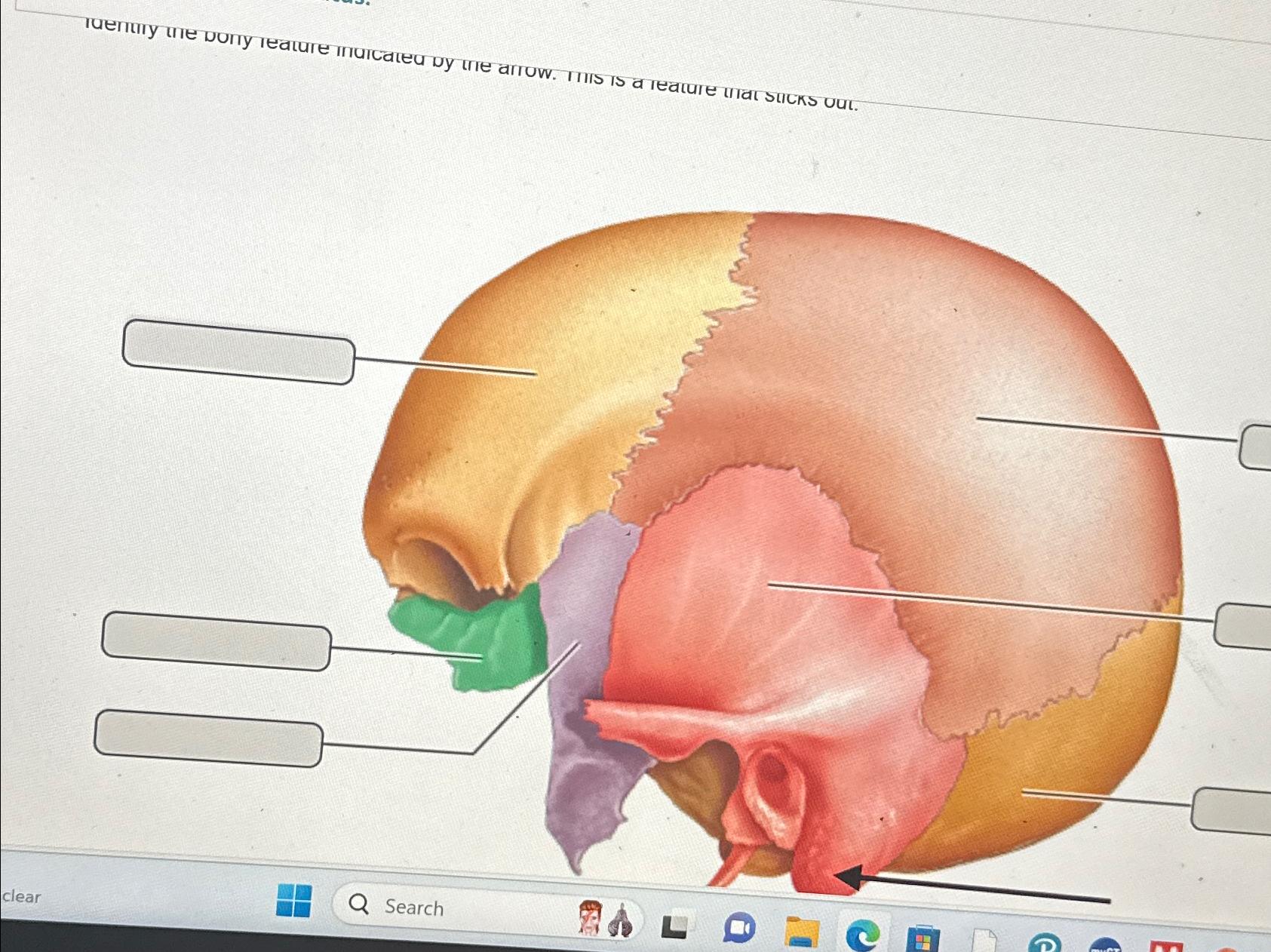 Identify the bony feature indicated by the arrow. | Chegg.com Identify the bony feature indicated by the arrow. | Chegg.com