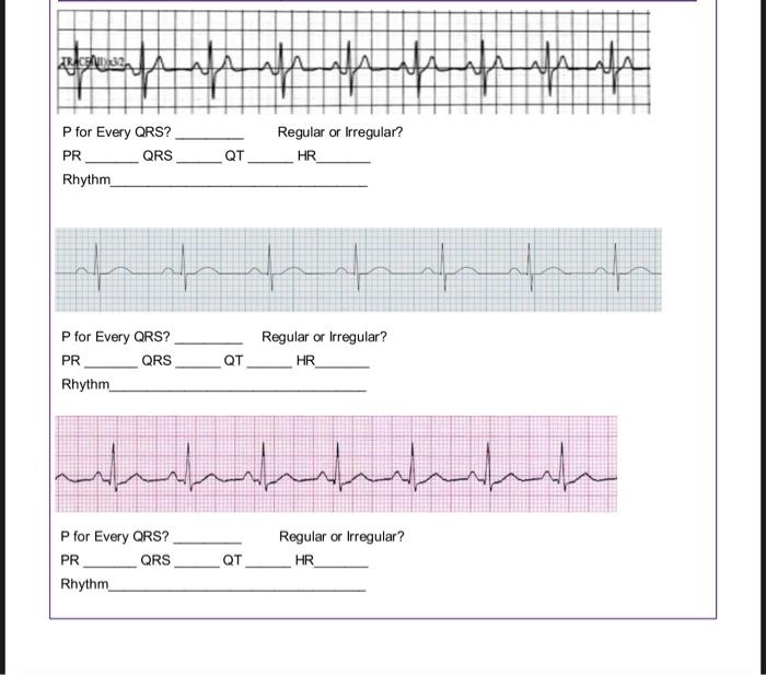 Solved P for Every QRS? Regular or Irregular? PR QRS QT HR | Chegg.com