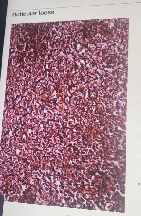 Solved Reticular loose | Chegg.com